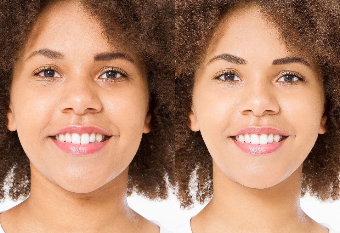 Full Body Whitening Treatment in Bangalore – Glow Instantly